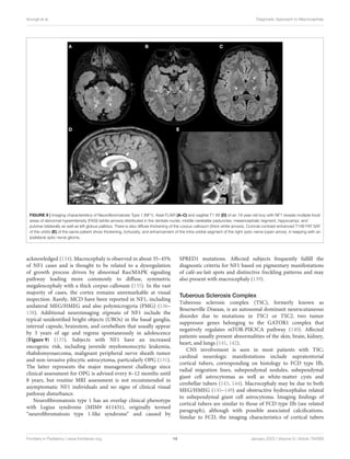 Diagnostic approach to macrocephaly in children | PDF