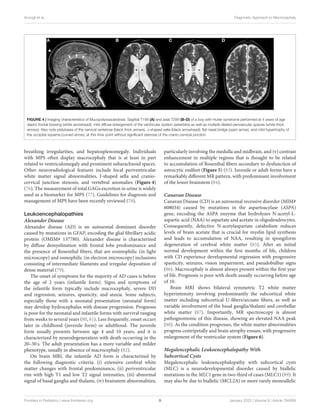 Diagnostic approach to macrocephaly in children | PDF