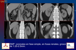 UROTOMOGRAFIA COMPUTADA | PPT