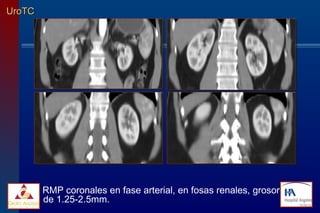 UROTOMOGRAFIA COMPUTADA | PPT