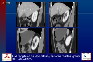 UROTOMOGRAFIA COMPUTADA | PPT