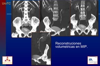 UROTOMOGRAFIA COMPUTADA | PPT