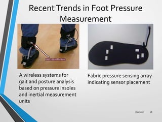 Foot Pressure Measurement System | PPTX