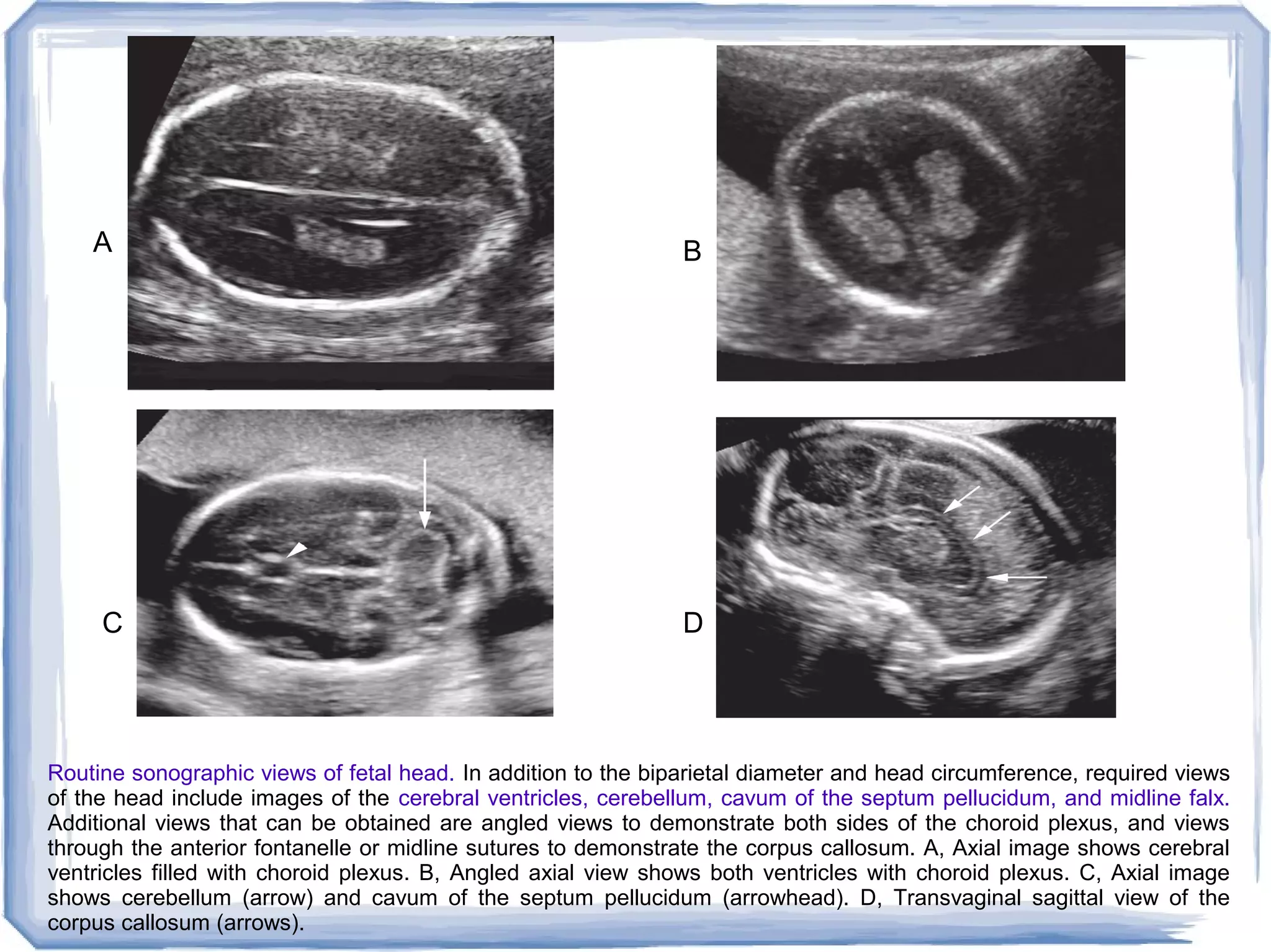 first trimester ultrasound and overview of obs imaging | PPT