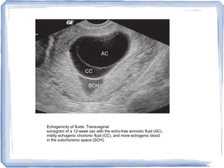 first trimester ultrasound and overview of obs imaging | PPT