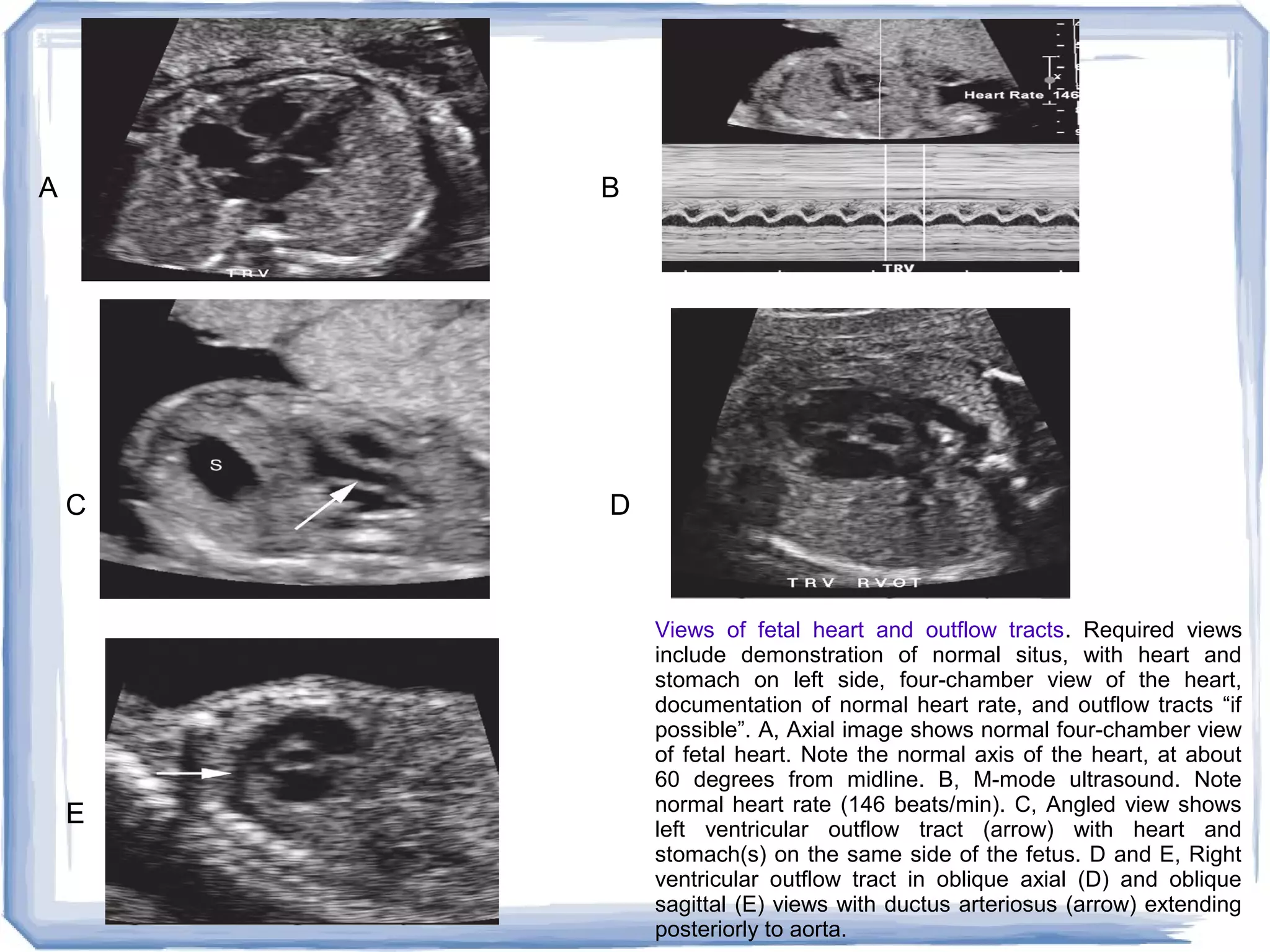 first trimester ultrasound and overview of obs imaging | PPT