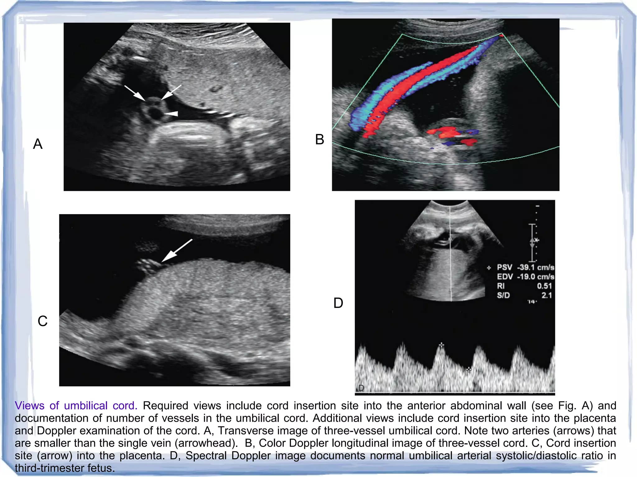 first trimester ultrasound and overview of obs imaging | PPT