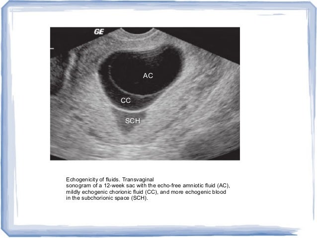 first trimester ultrasound and overview of obs imaging
