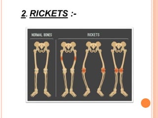 CALCIUM IN BIOLOGICAL SYSTEM | PPT