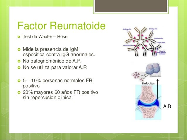 FACTOR REUMATOIDE - ASTO