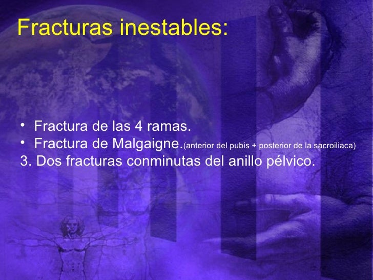 Fractura De Pelvis