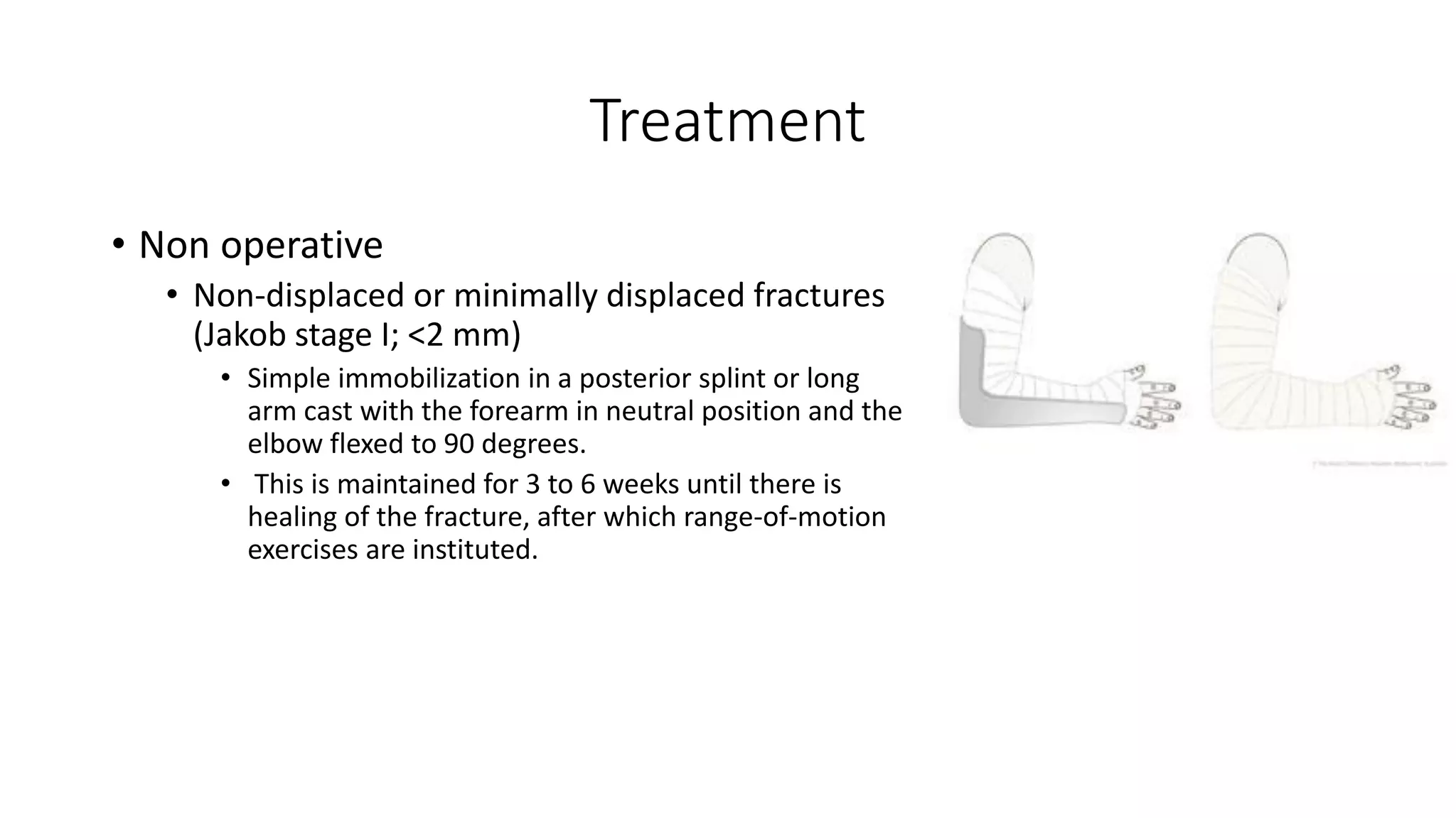 Fractures around elbow lateral condyle and intercondylar fractures | PDF