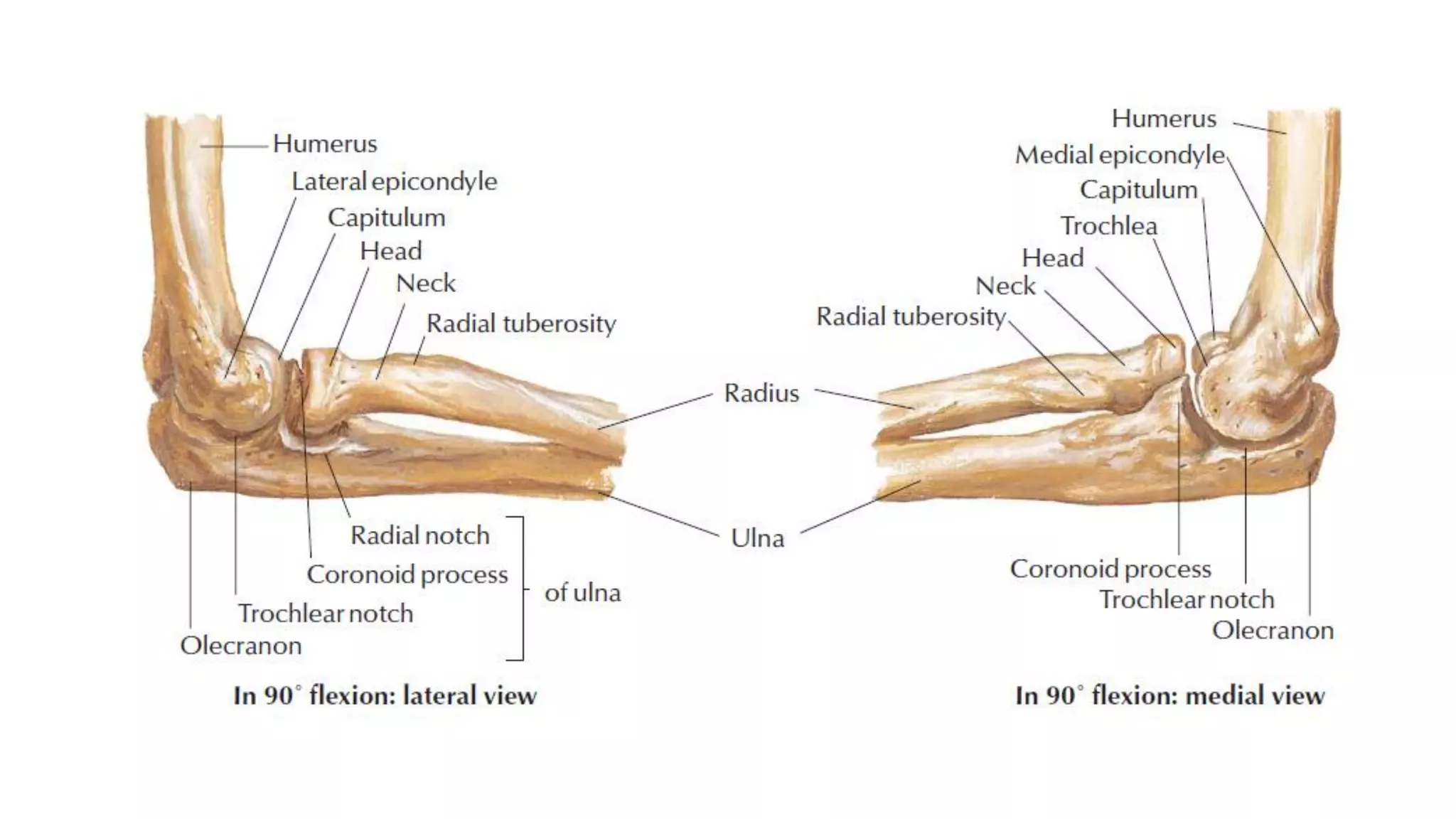 Fractures around elbow lateral condyle and intercondylar fractures | PDF