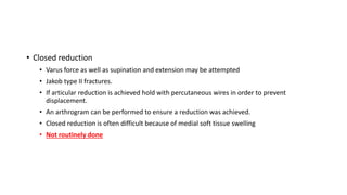 Fractures around elbow lateral condyle and intercondylar fractures | PDF