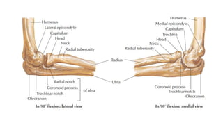 Fractures around elbow lateral condyle and intercondylar fractures | PDF