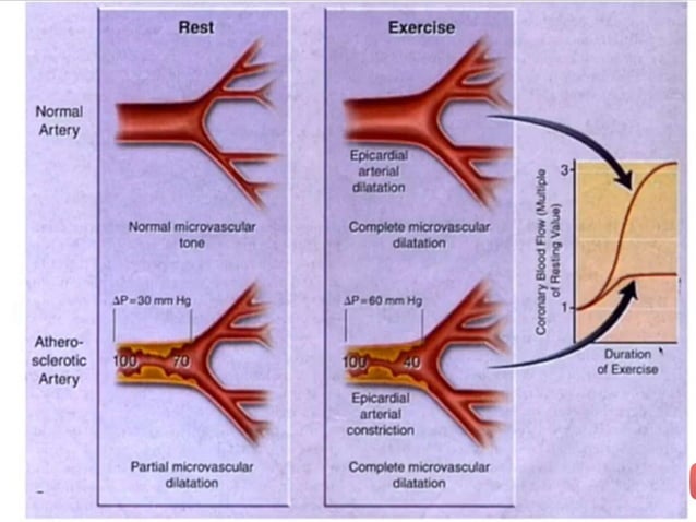 Fraction flow reserve | PPTX | Heart and Cardiovascular Diseases ...