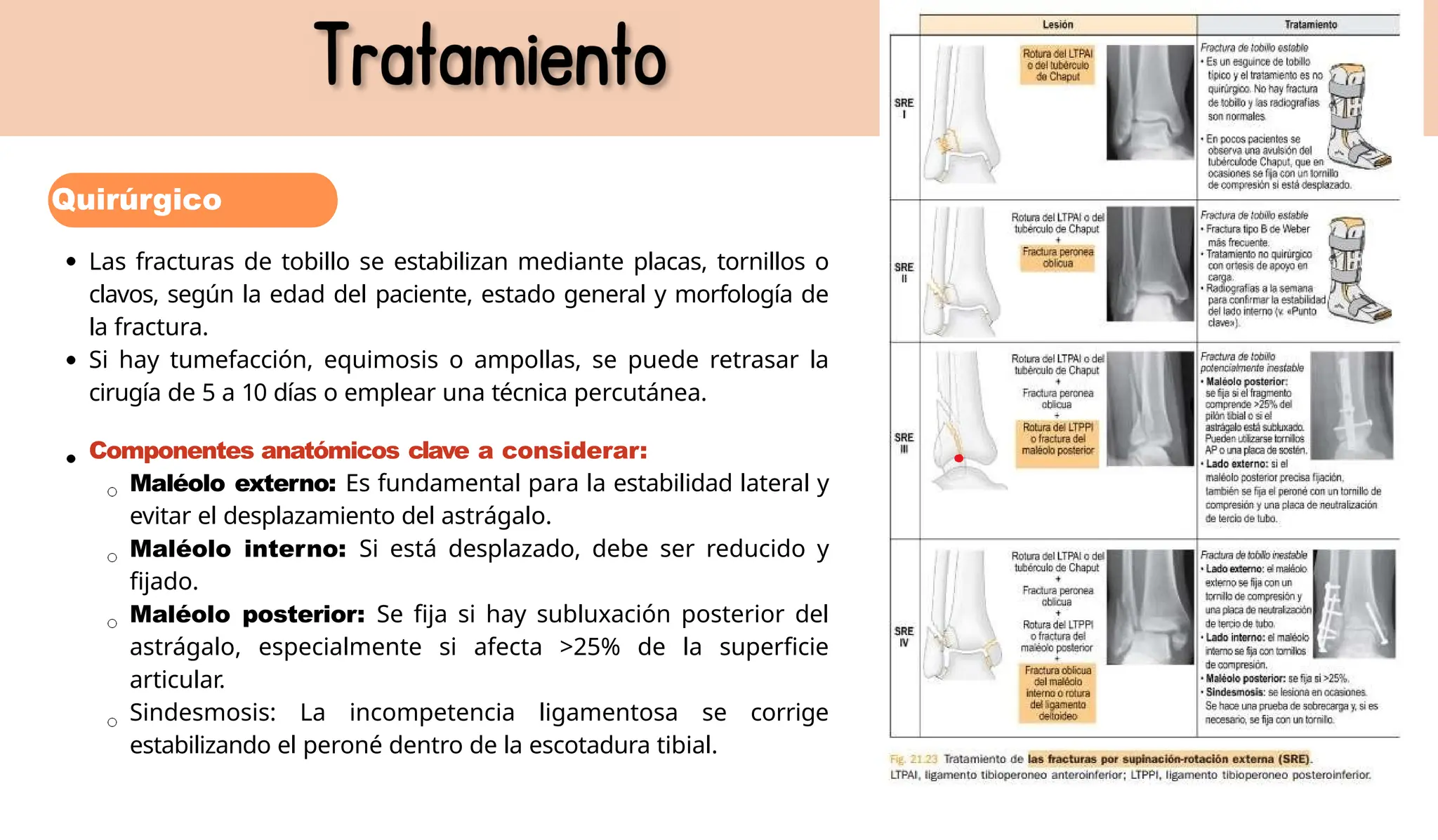 Presentación de fractura-de-tobillo en medicina | PPTX