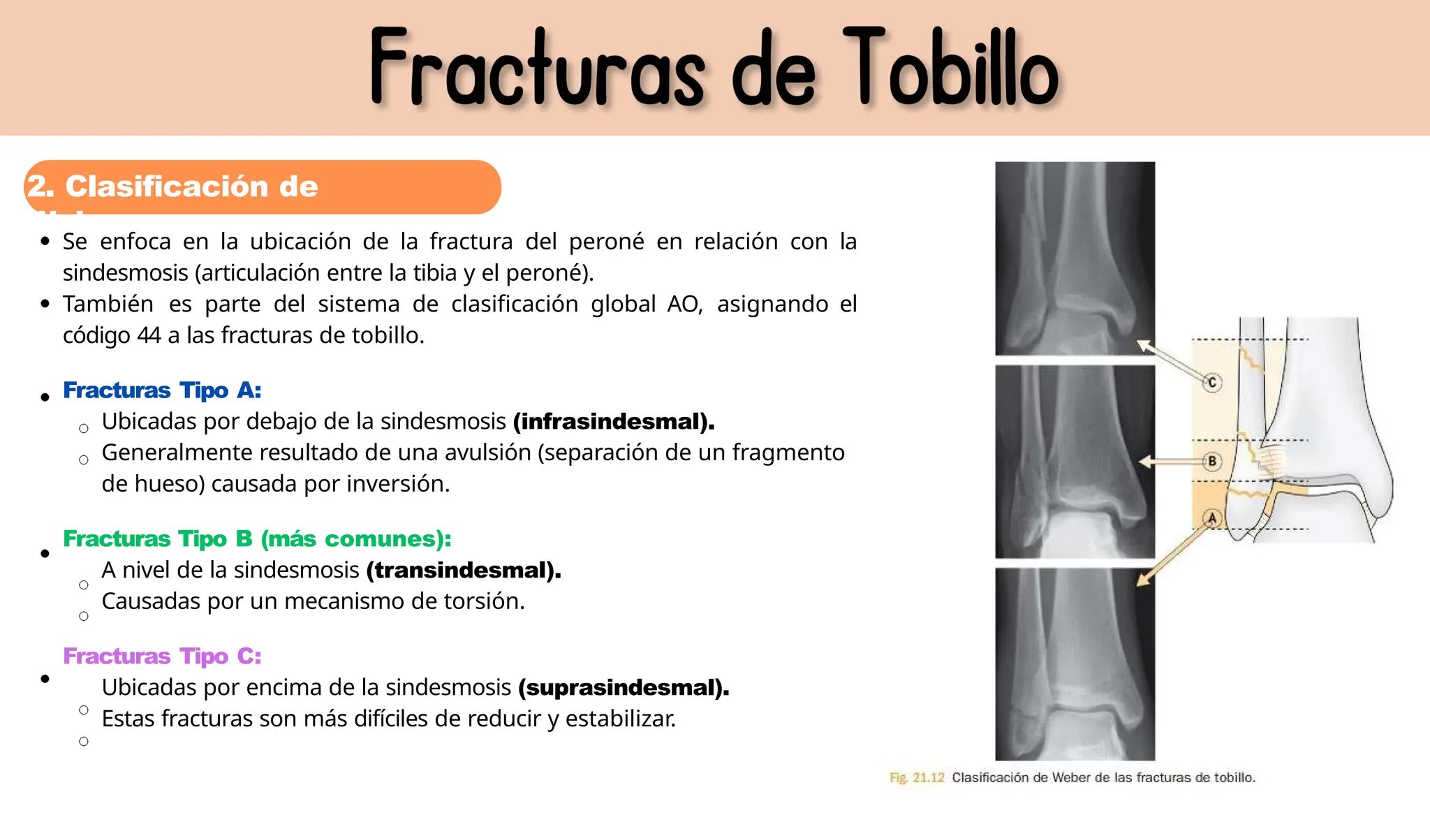 Presentación de fractura-de-tobillo en medicina | PPTX