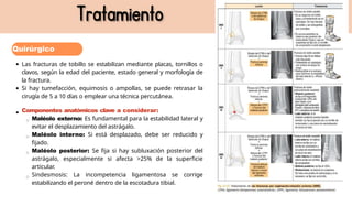 Presentación de fractura-de-tobillo en medicina | PPTX