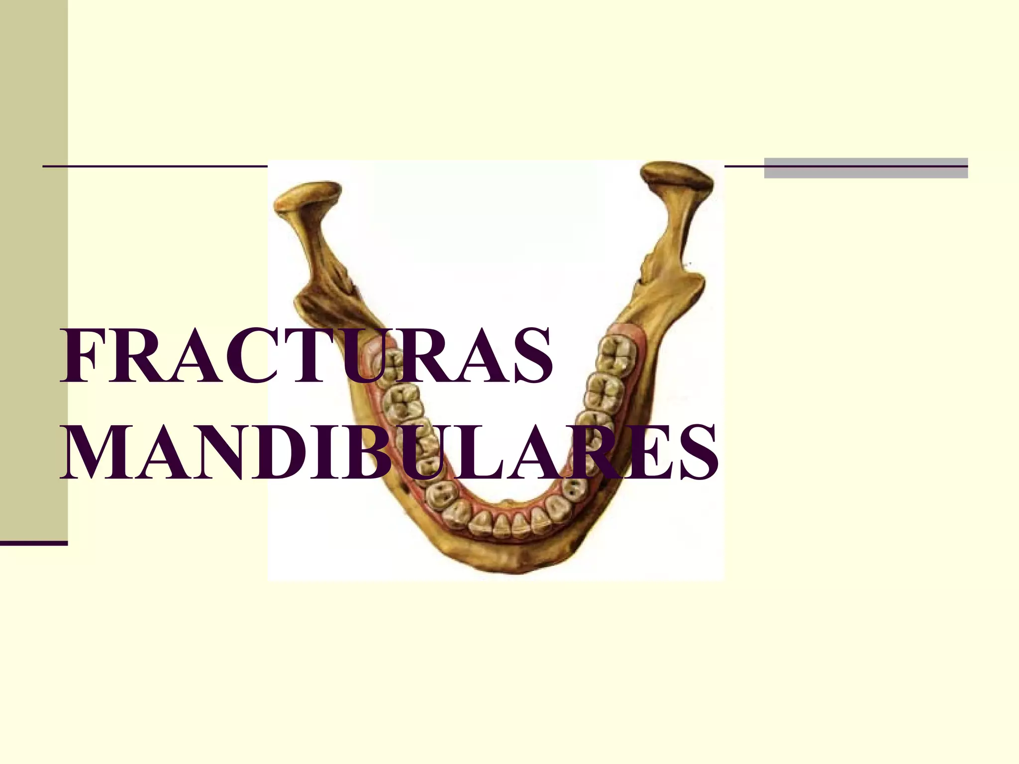 Fractura Mandibular Examen | PPT | Bone and Joint Conditions | Diseases ...