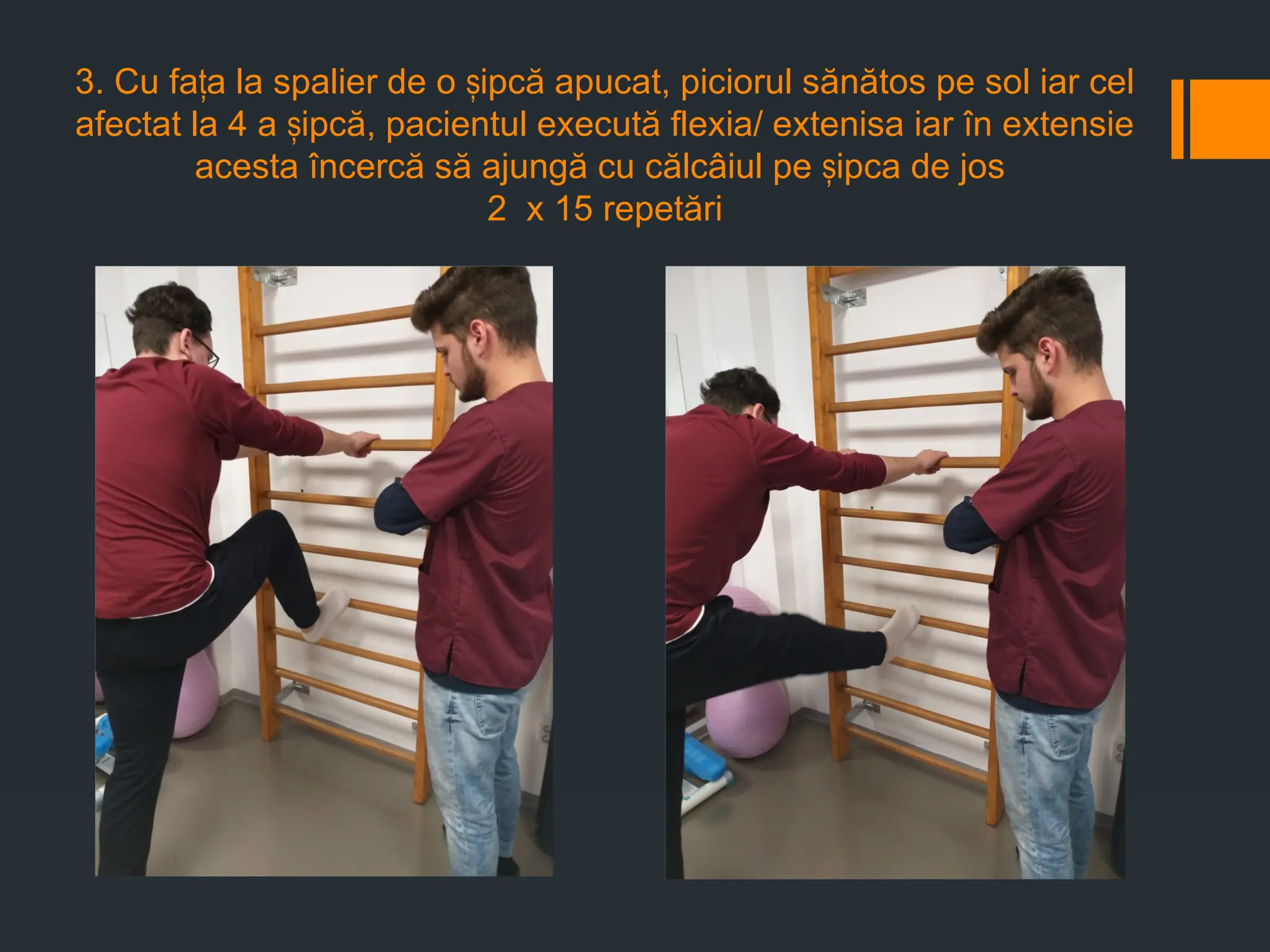 fractura condil-prezentare ppt despre.pptx