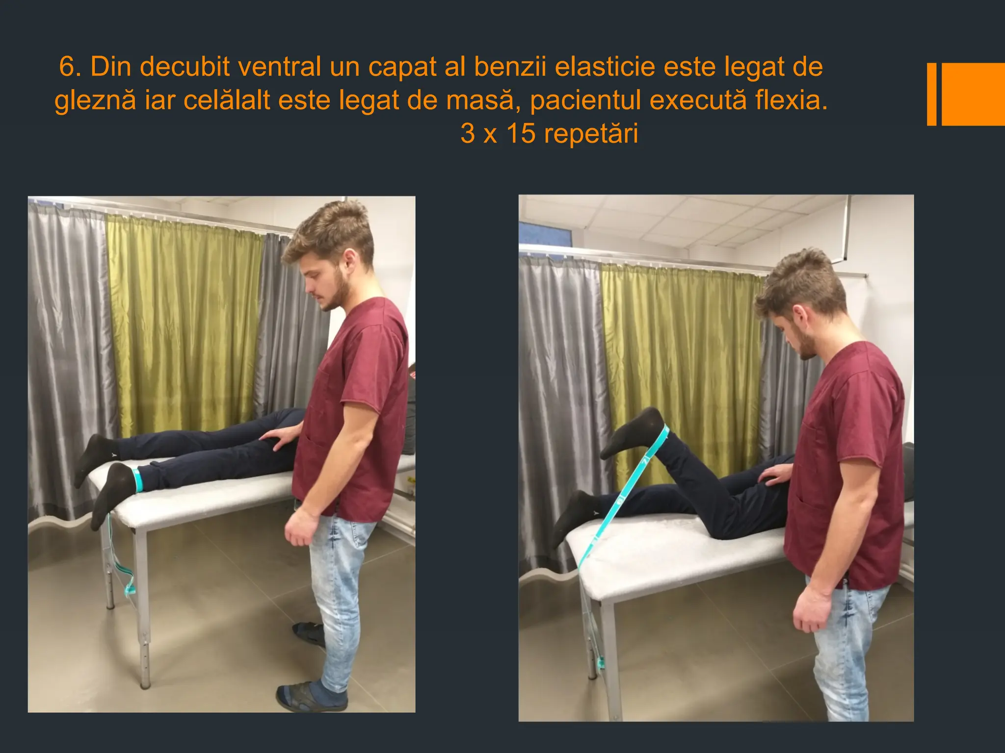 fractura condil-prezentare ppt despre.pptx