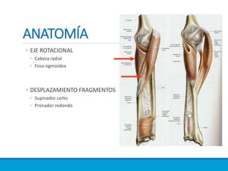 Fractura de antebrazo | PPTX