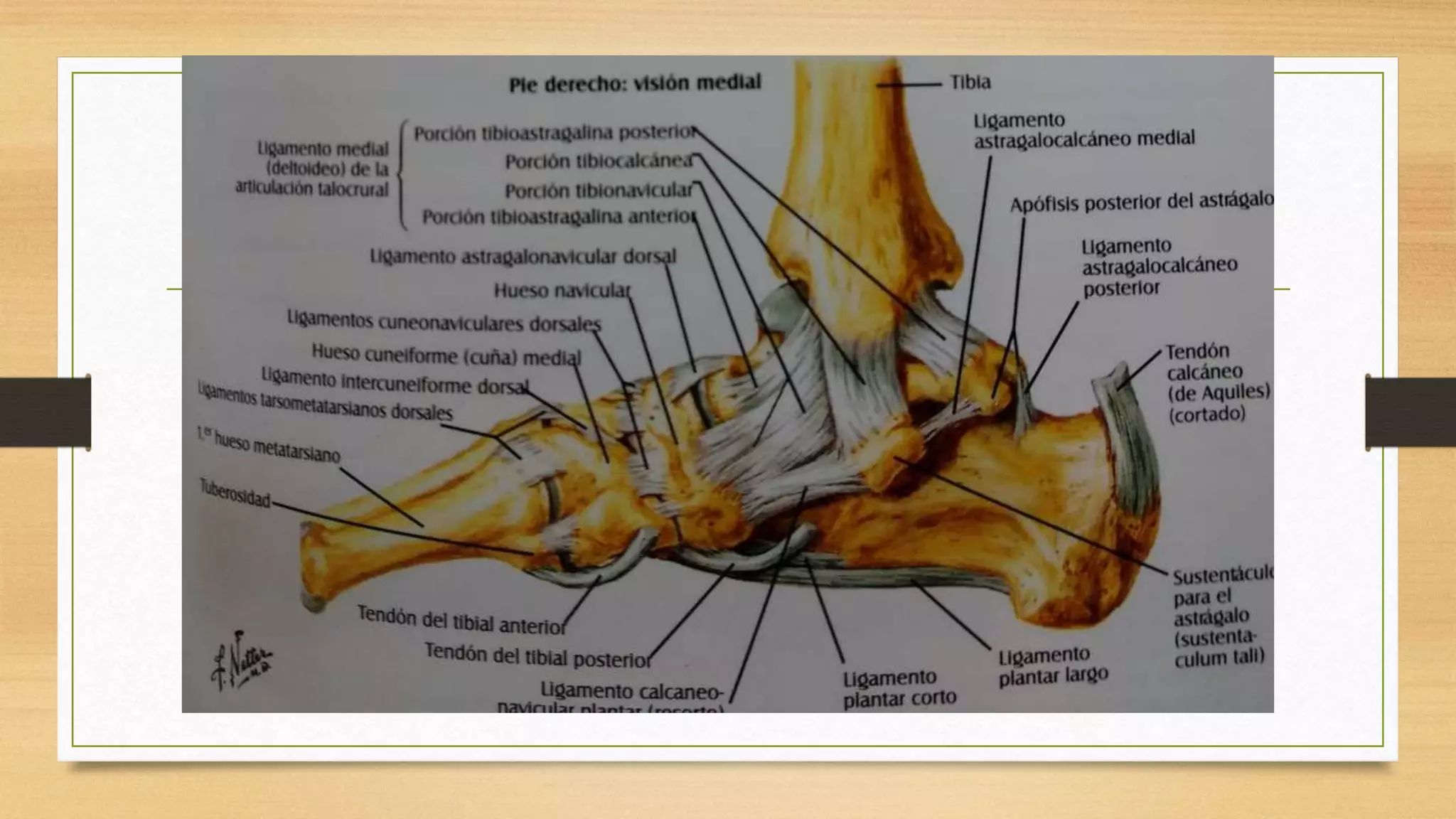 Fractura de calcaneo | PPTX