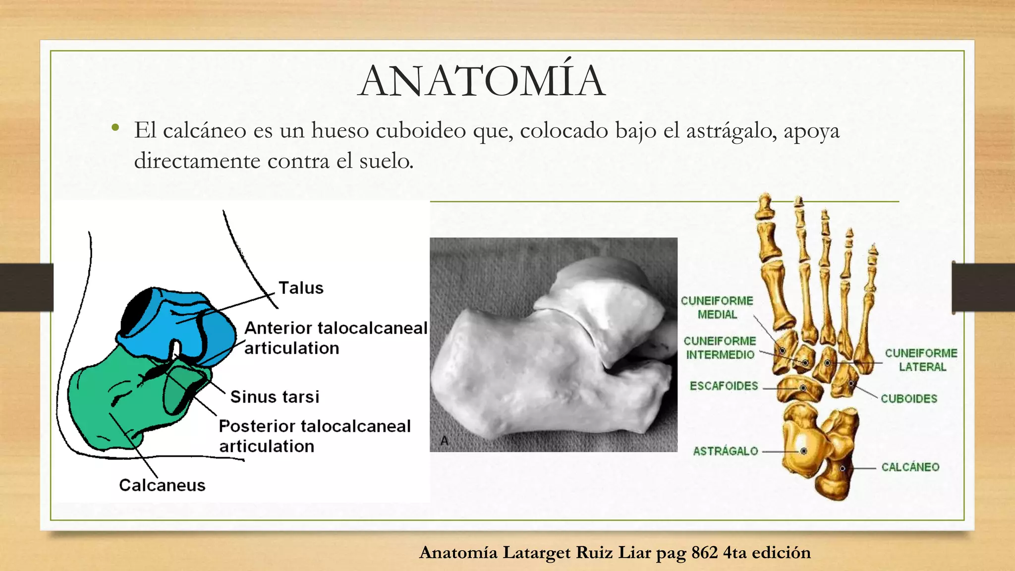 Fractura de calcaneo | PPTX