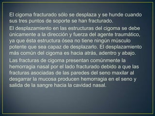 Fractura de cara | PPTX