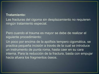 Fractura de cara | PPTX