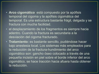Fractura de cara | PPTX