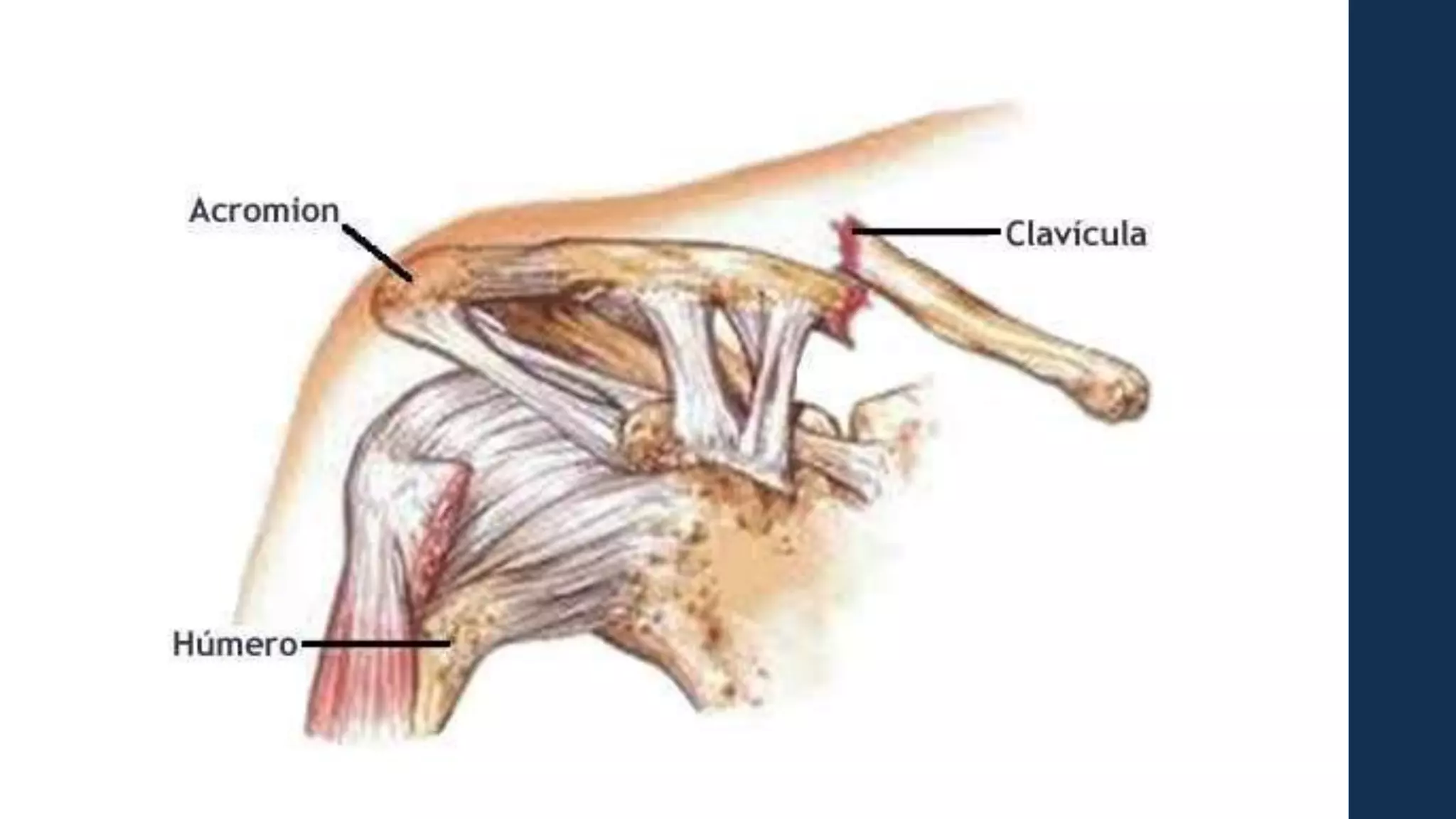 Fractura de clavícula.pptx