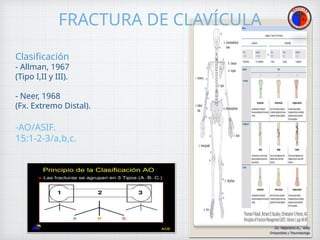 FRACTURA DE CLAVICULA (cíngulo escapular y extremidad torácica).pptx