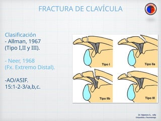 FRACTURA DE CLAVICULA (cíngulo escapular y extremidad torácica).pptx