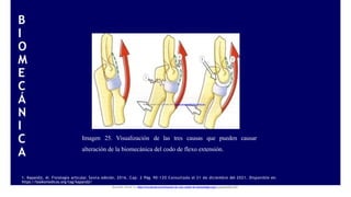 luxofractura de codo tipos de fracturas del humero distal.pptx