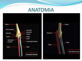 Fractura de codo | PPTX