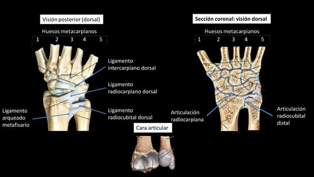 fractura de colles traumatologia, muñeca | PPT