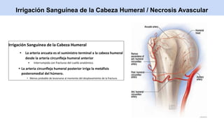 Fractura de húmero proximaL. MEDICINA HUMANA | PDF