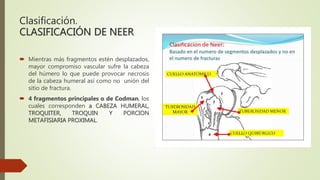 Fracturas de Humero | PPT