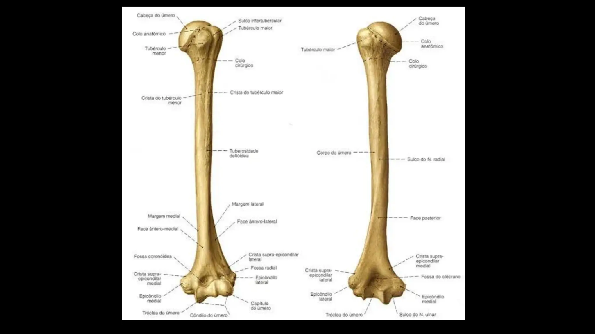 FRACTURA DE HUMERO DISTAL se comenta los tipos de fractura de humero ...