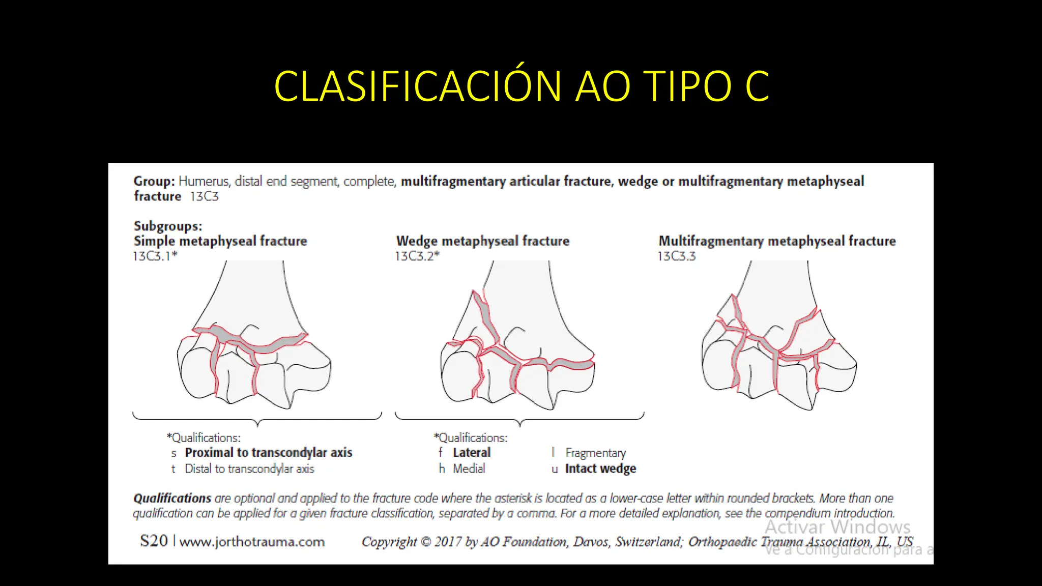 FRACTURA DE HUMERO DISTAL se comenta los tipos de fractura de humero ...