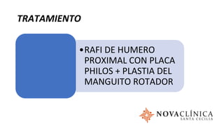 Fractura de humero proximal. del miembro superior derecho | PPTX