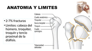 DIAPOSITIVAS DE FRACTURA DE HUMERO PROXIMAL | PPTX