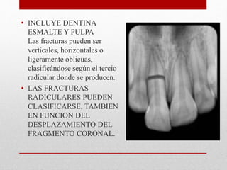 Fractura de la raiz | PPTX
