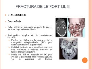 FRACTURA DE LE FORT.pptx