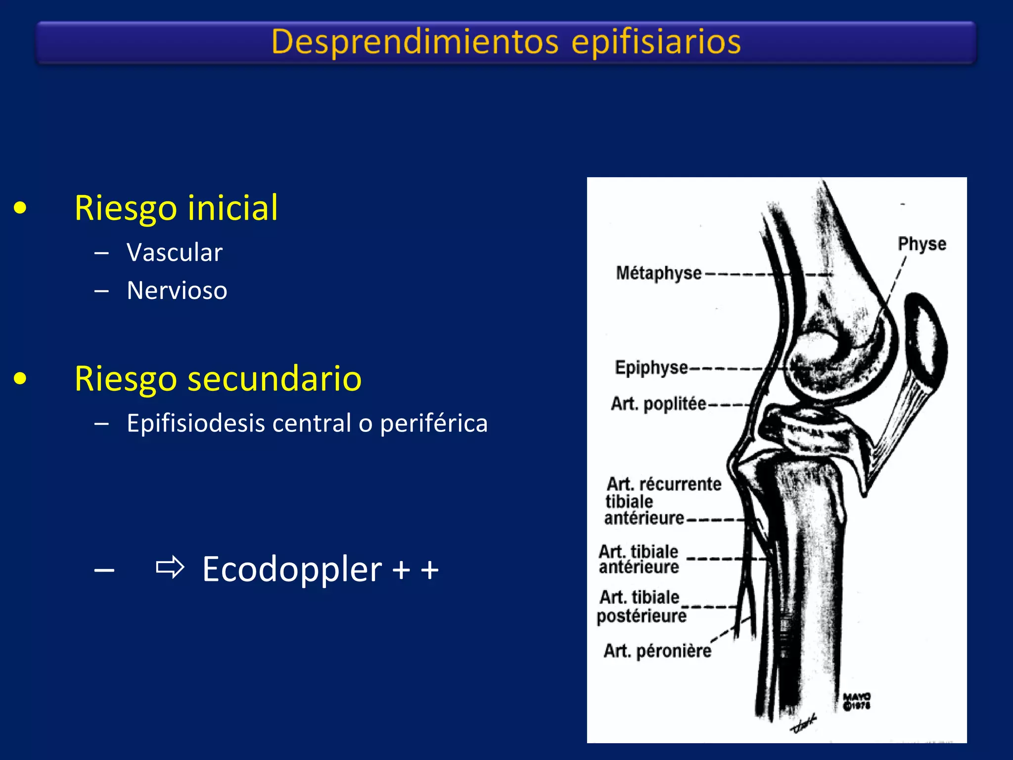 Fractura del extremo distal del femur | PPT
