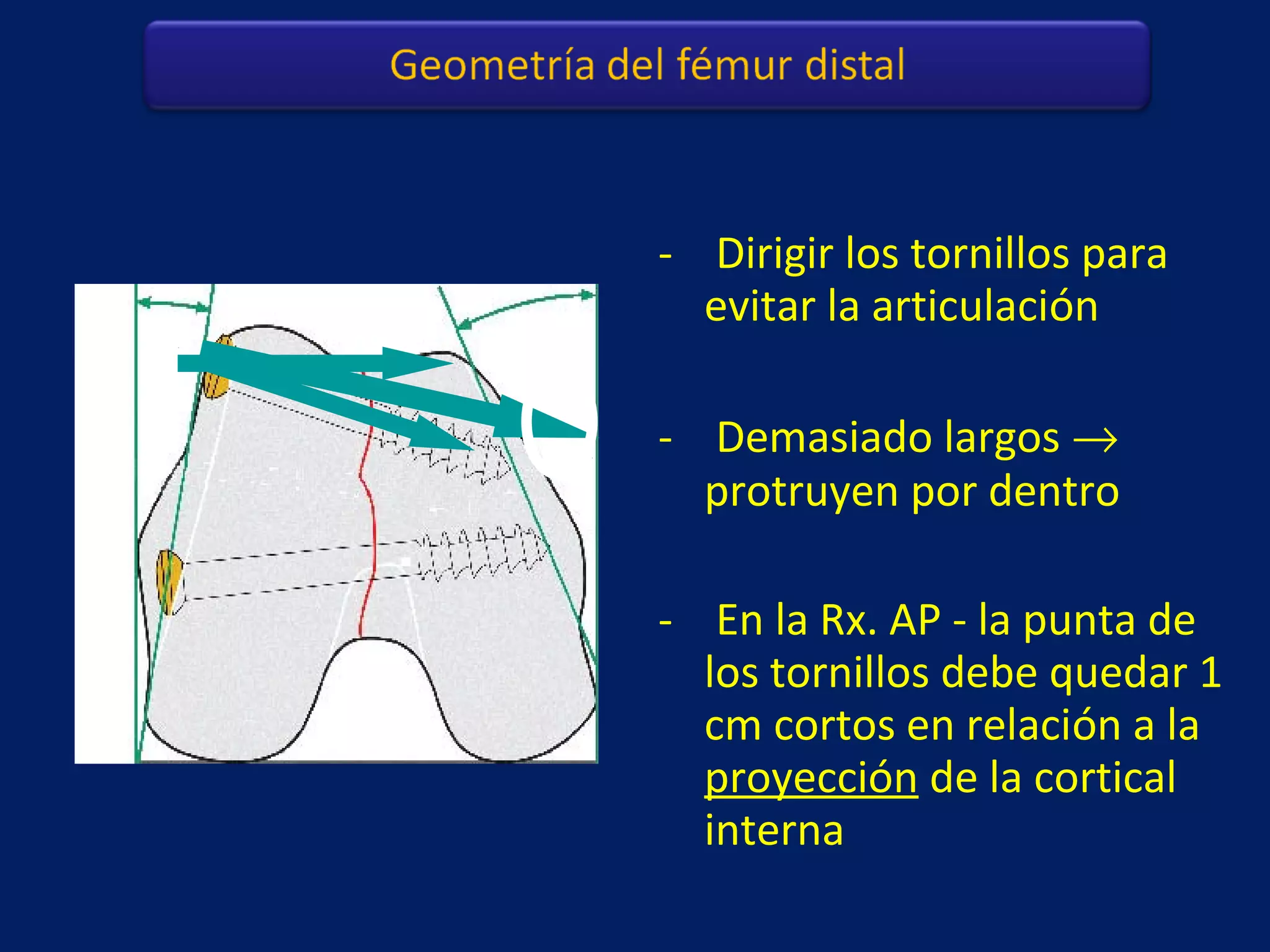 Fractura del extremo distal del femur | PPT