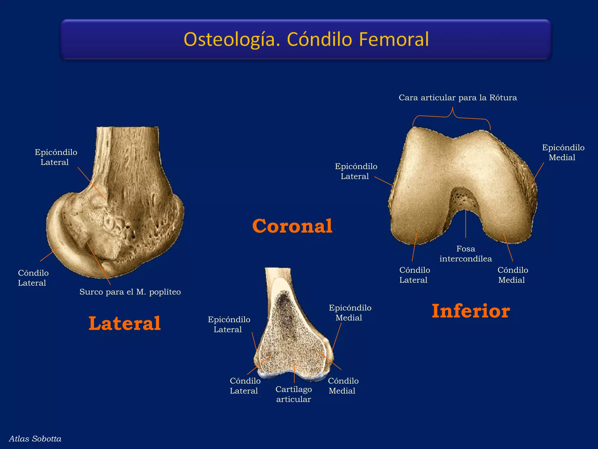 Fractura del extremo distal del femur | PPT