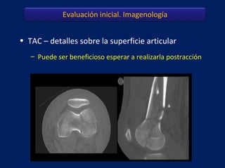 Fractura del extremo distal del femur | PPT